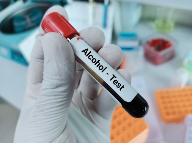 7 Types of Alcohol Tests | Fastest Labs