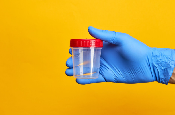 How to Prepare for a Drug Test | Fastest Labs