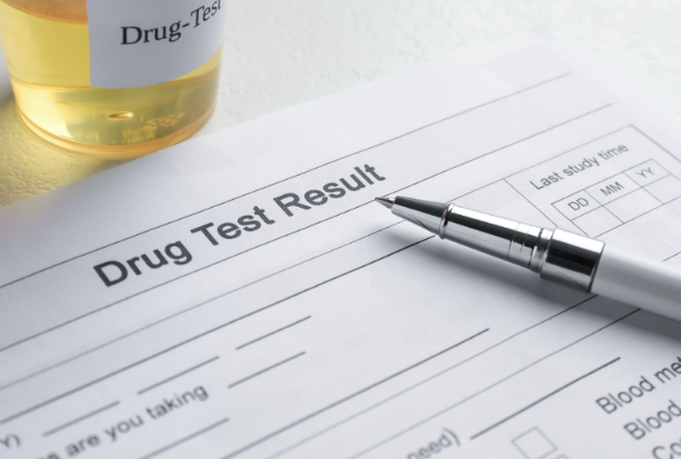 Reasonable Suspicion Drug Testing