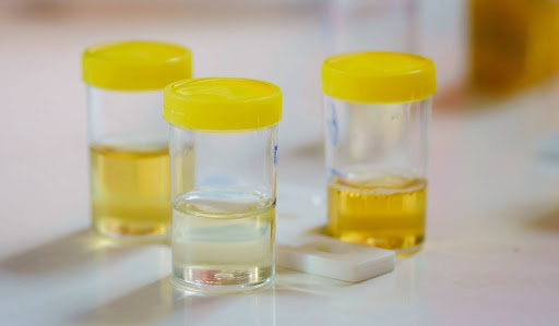 Understanding Mobile Drug Testing | Fastest Labs